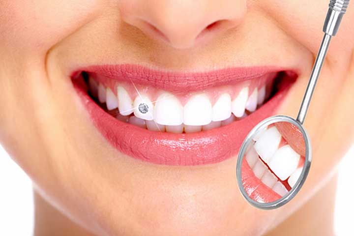 Tooth jewellery | Best Dental Clinic for Braces +91 83838 07453 Call Now
